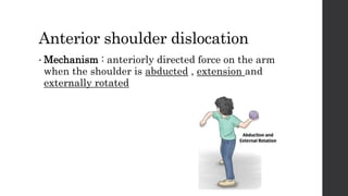 Ant.shoulder dislocation | PPT
