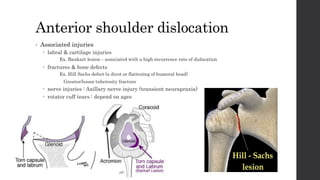 Ant.shoulder dislocation | PPT