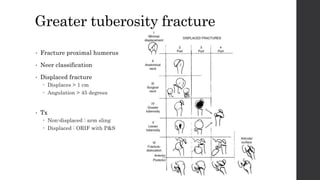 Ant.shoulder dislocation | PPT