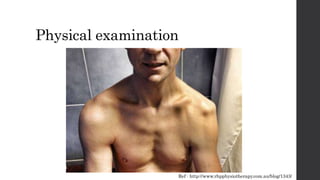 Ant.shoulder dislocation | PPTX