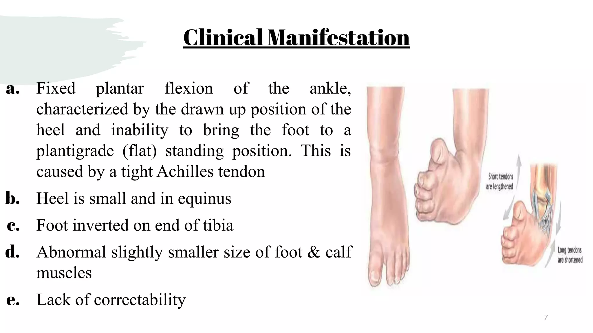Orthopedic abnormalities | PDF
