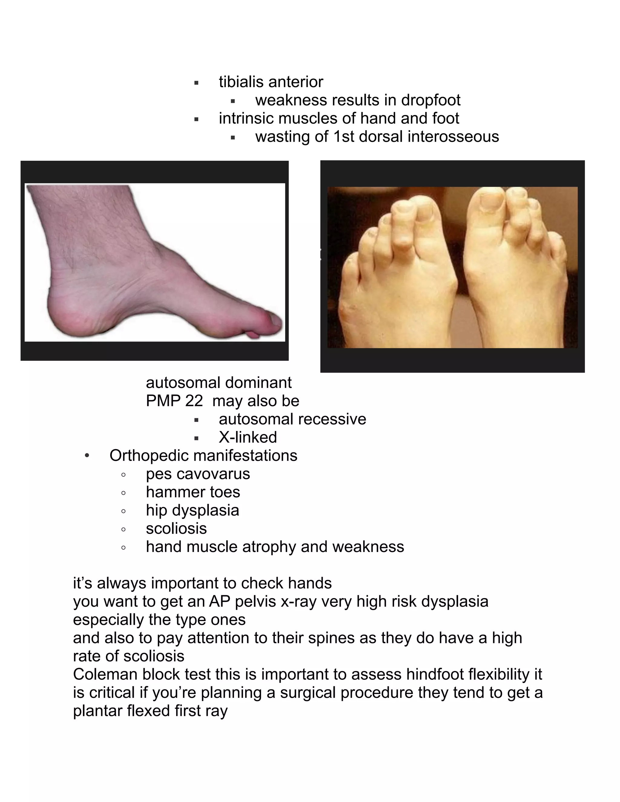 Orthopedic considerations in neuromuscular disorder | PDF