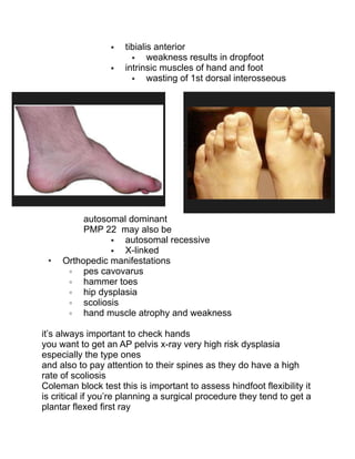 Orthopedic considerations in neuromuscular disorder | PDF