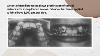 Orthopedic coordination of dentofacial development in skeletal Class II ...