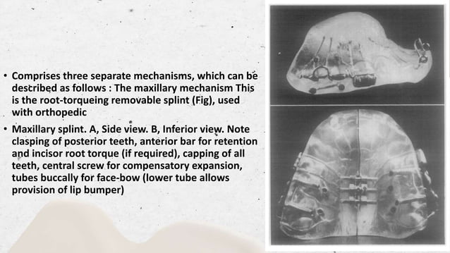 Orthopedic coordination of dentofacial development in skeletal Class II ...