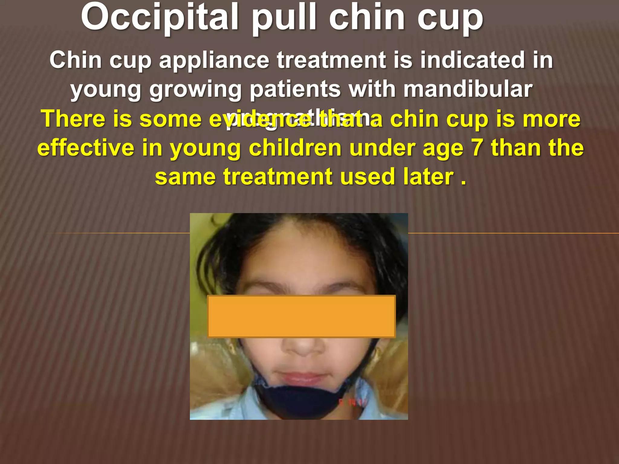 Orthopedic correction of class III | PPT