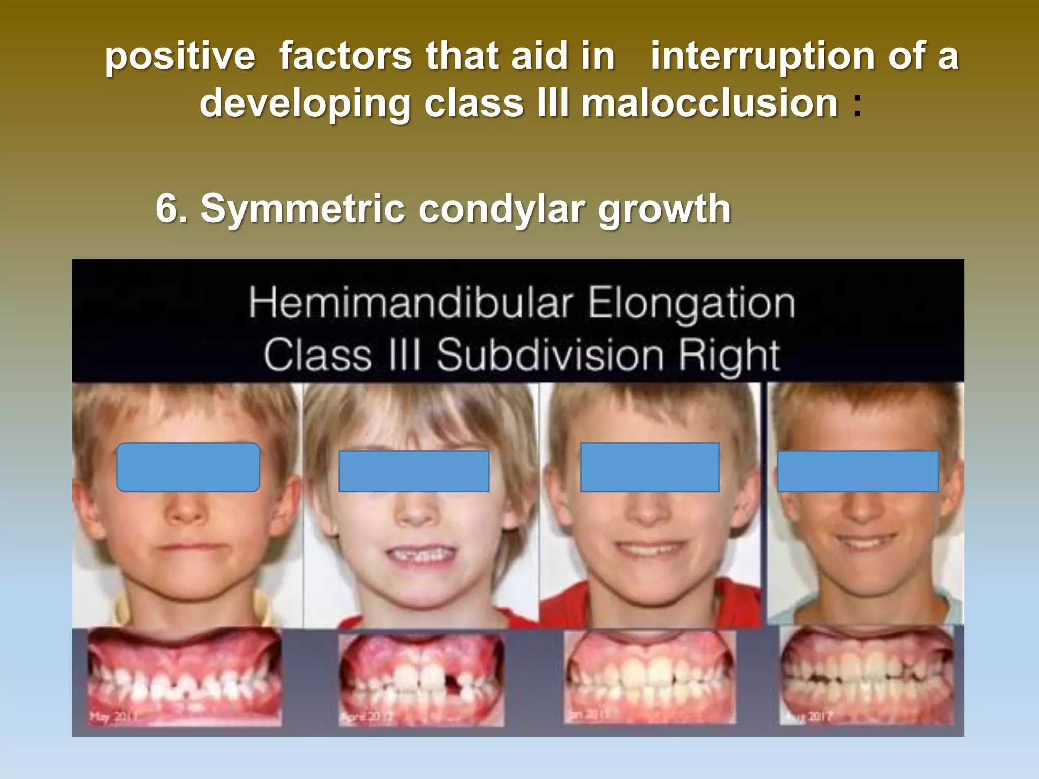 Orthopedic correction of class III | PPT
