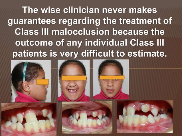 Orthopedic correction of class III | PPT