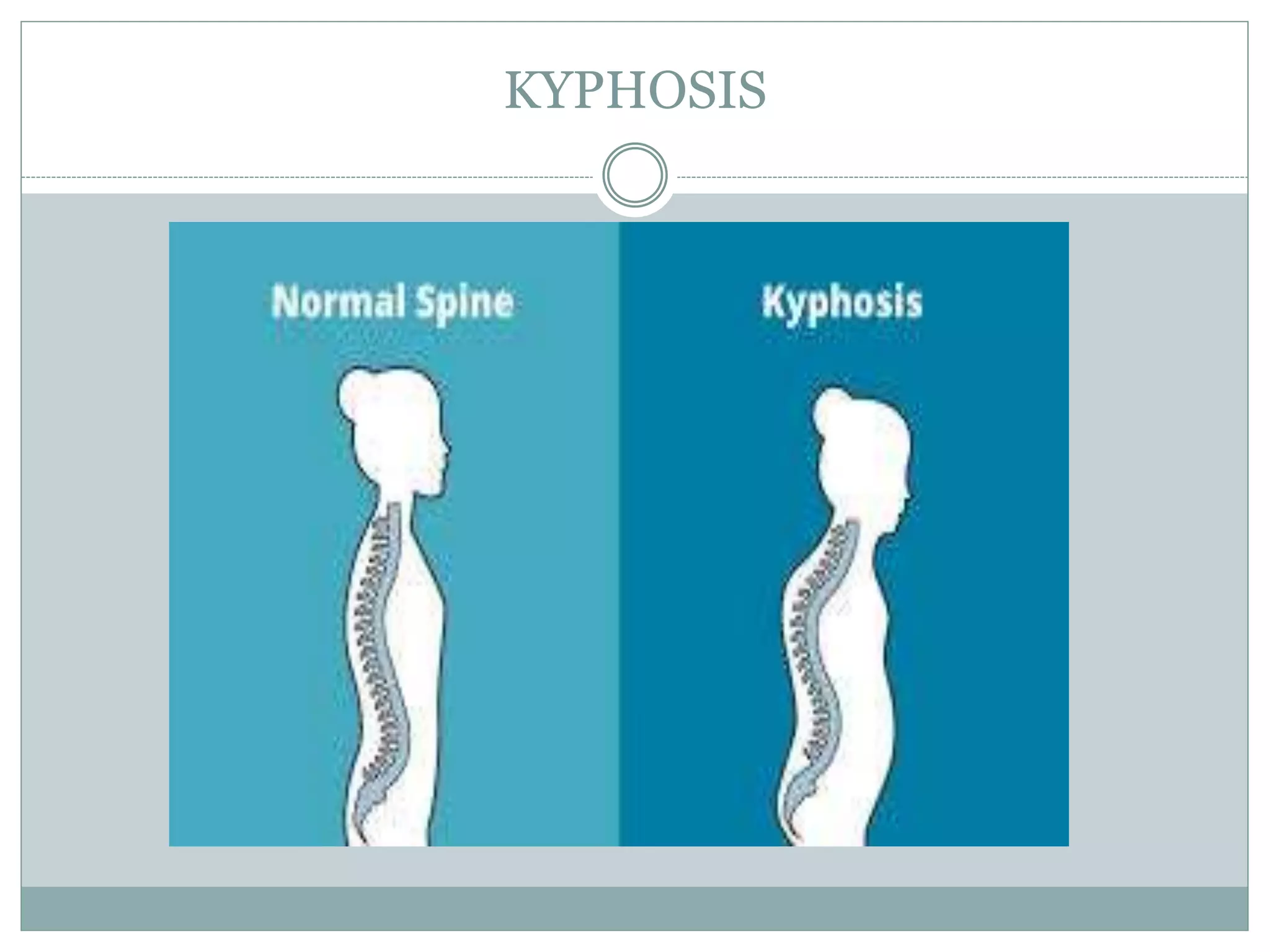 Orthopedic disorders in children | PPTX