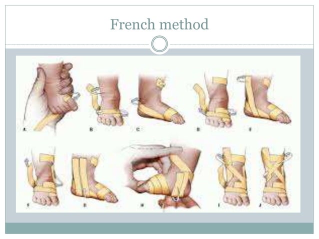 Orthopedic disorders in children | PPTX