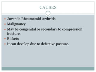 Orthopedic disorders in children | PPTX