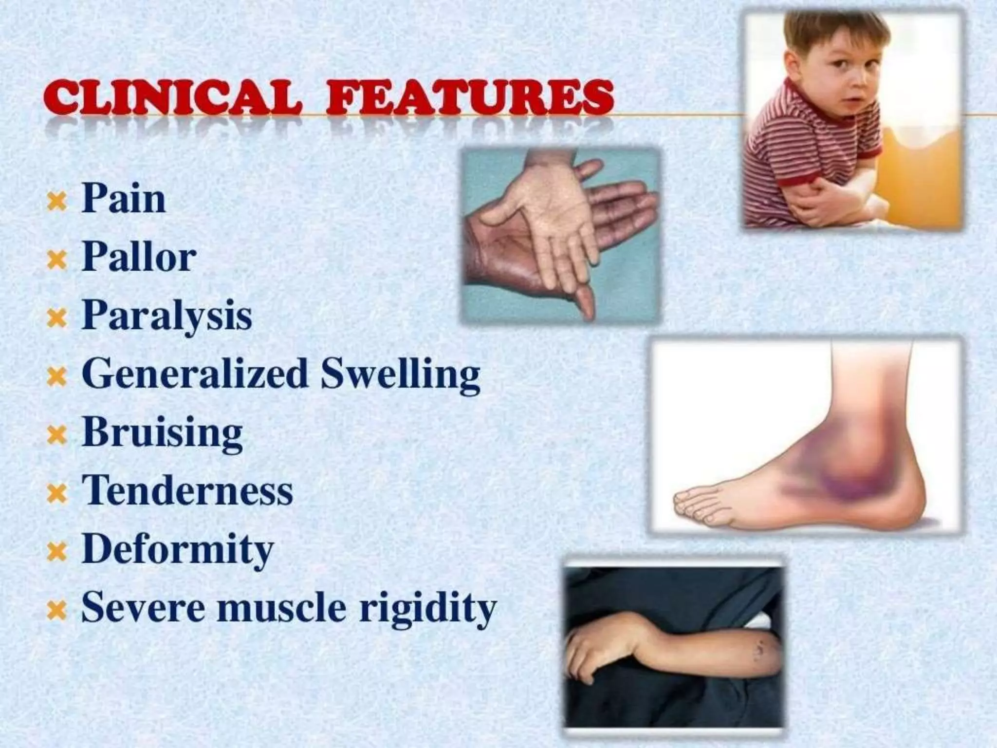 Orthopedic Disorders In Children.pptx