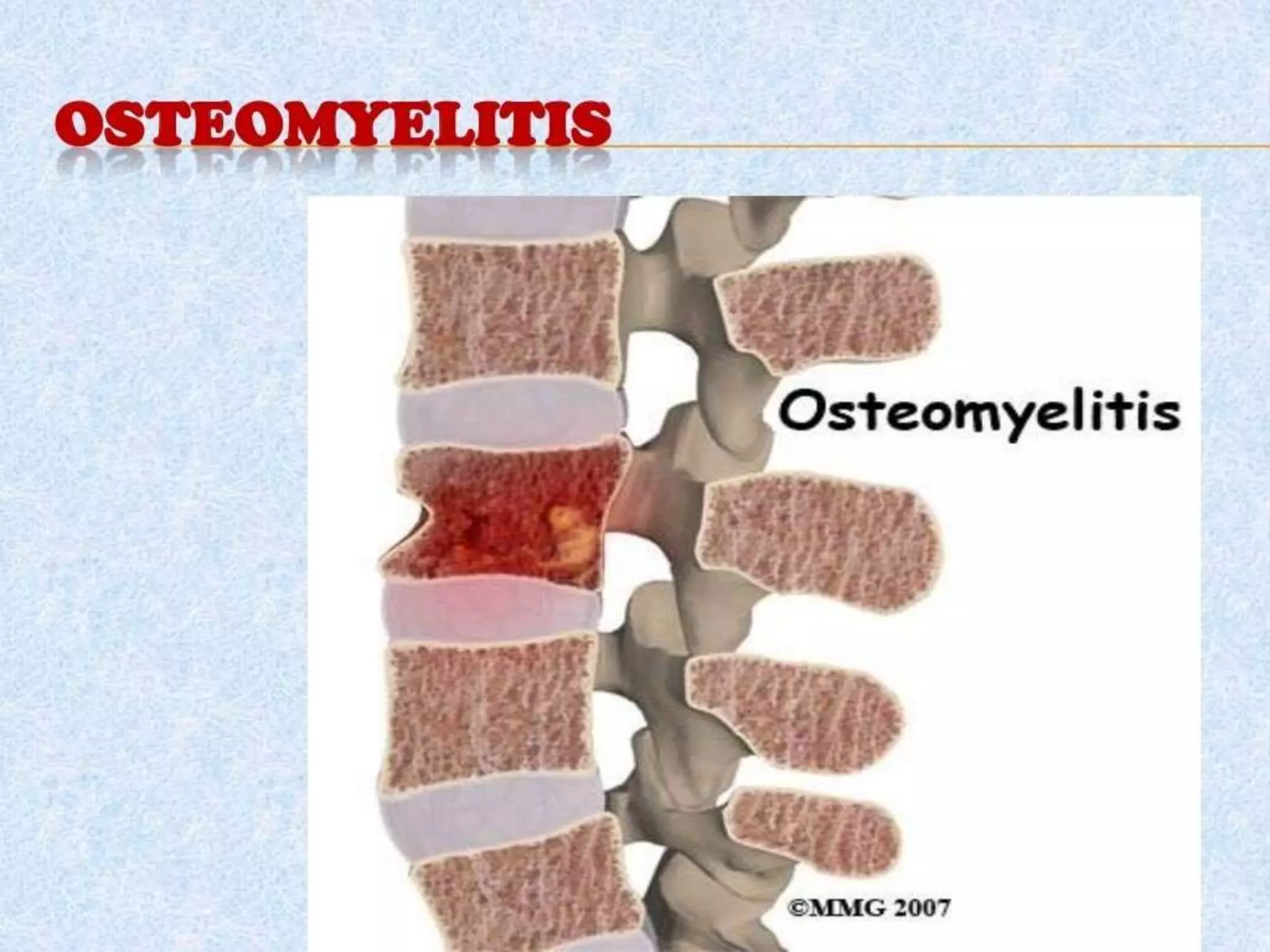 Orthopedic Disorders In Children.pptx