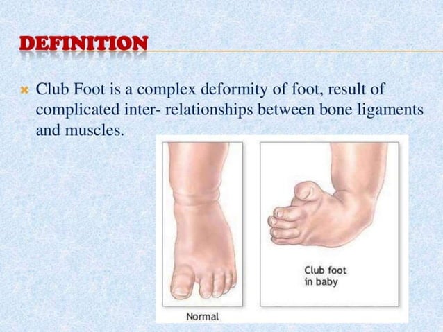 Orthopedic Disorders In Children.pptx
