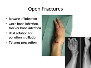Orthopedic Emergencies in hospitality ppt | PPT