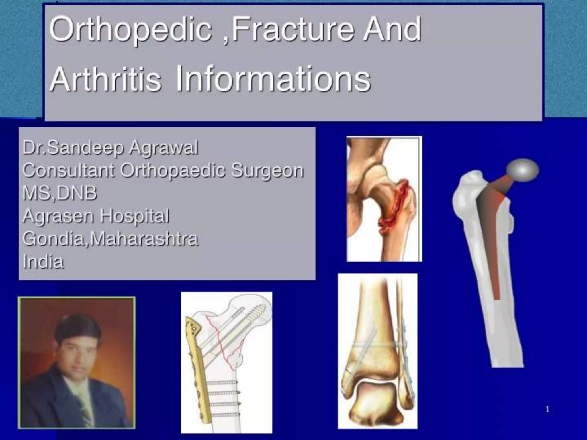 Orthopedic ,fracture and arthritis knowledge Online informations dr ...