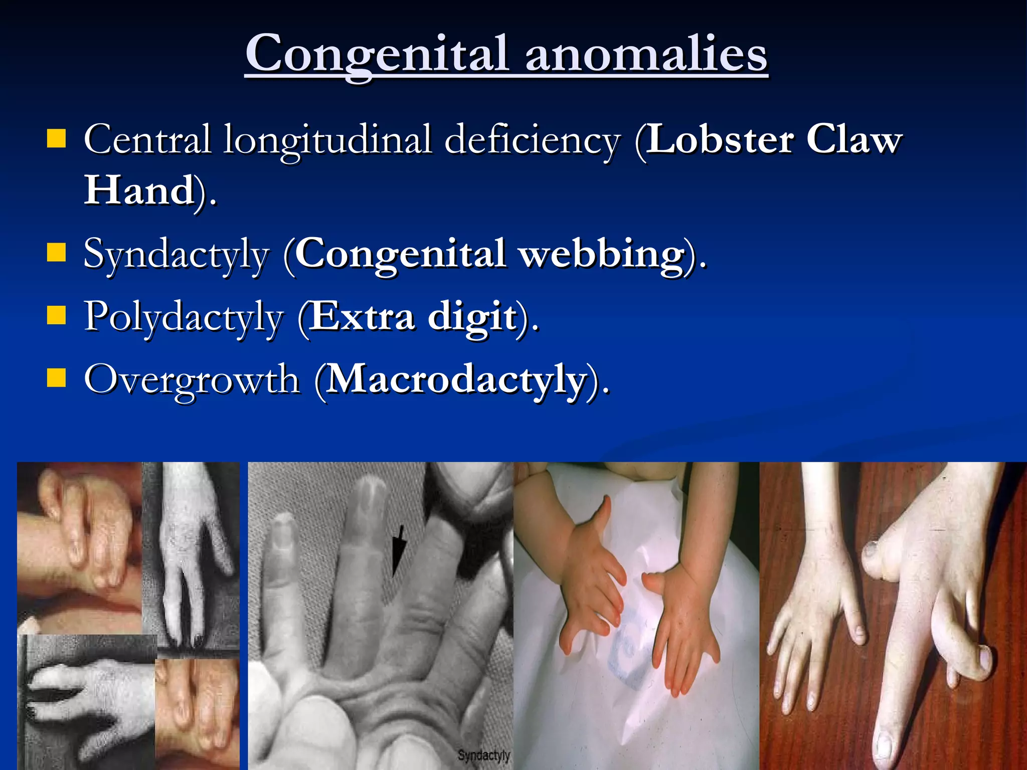 Orthopedics 5th year, 5th lecture (Dr. Ariwan) | PPT