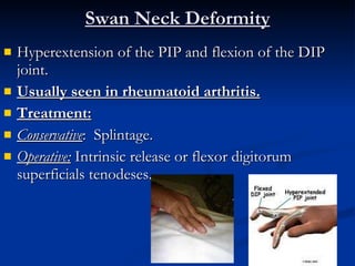 Orthopedics 5th year, 5th lecture (Dr. Ariwan) | PPT