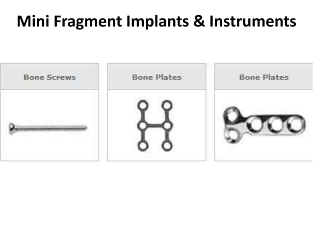 Orthopedic implants | PPTX
