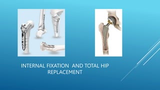 Orthopedic implants.pptx