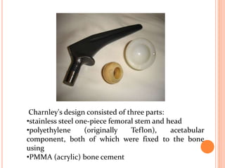 Orthopedic implants used in Operation Theater | PPTX