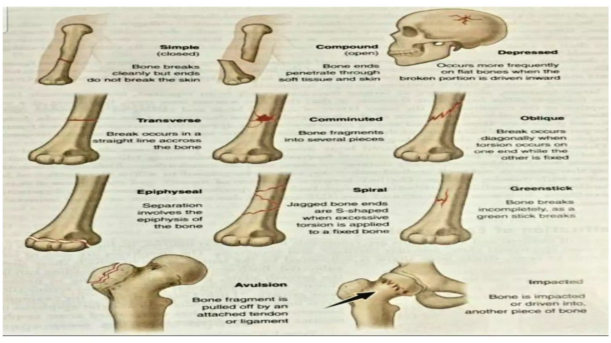Orthopedic Nursing AHN2 unit one_2.pdf