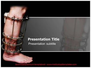 Orthopaedic power point template | PPTX