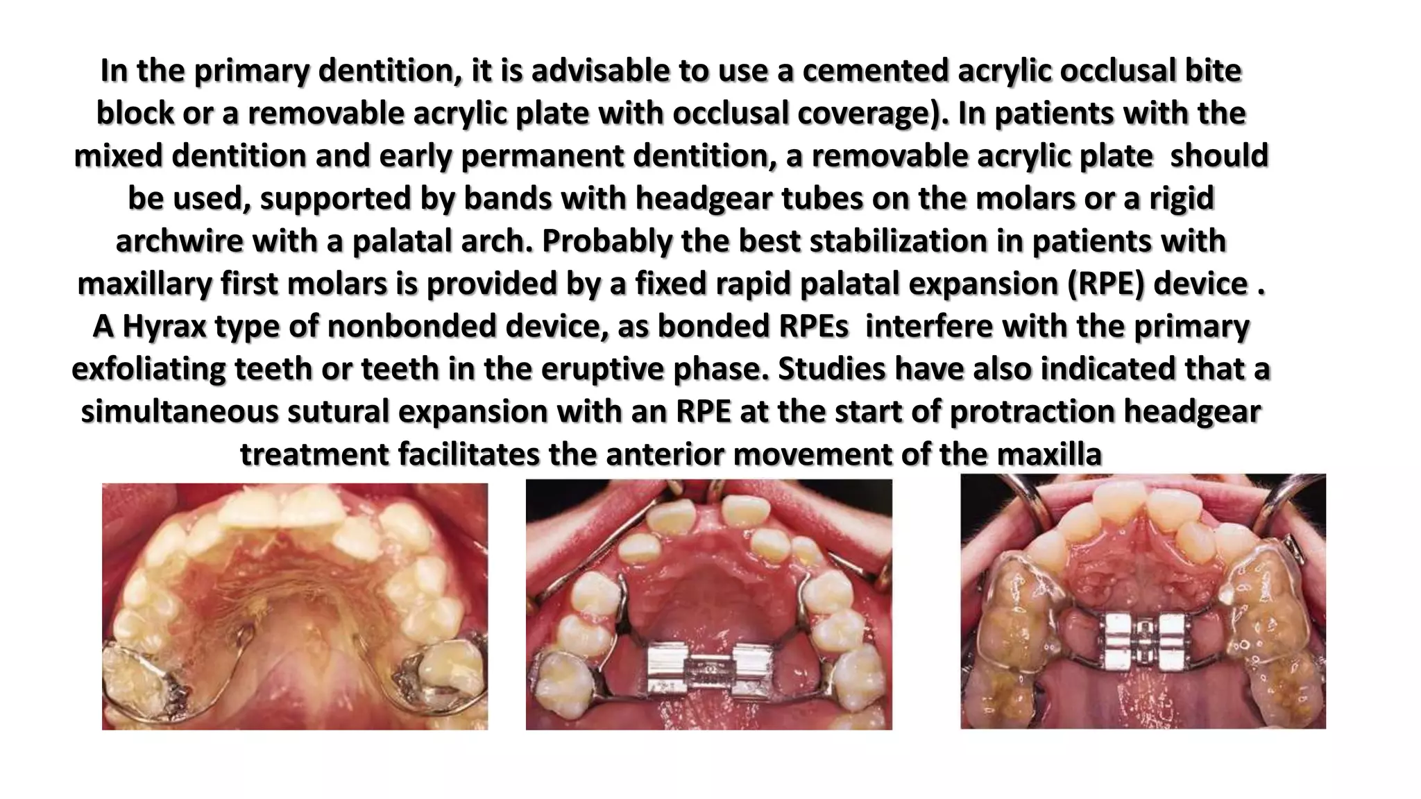 Orthopedic protraction of the maxilla part 1 | PPTX