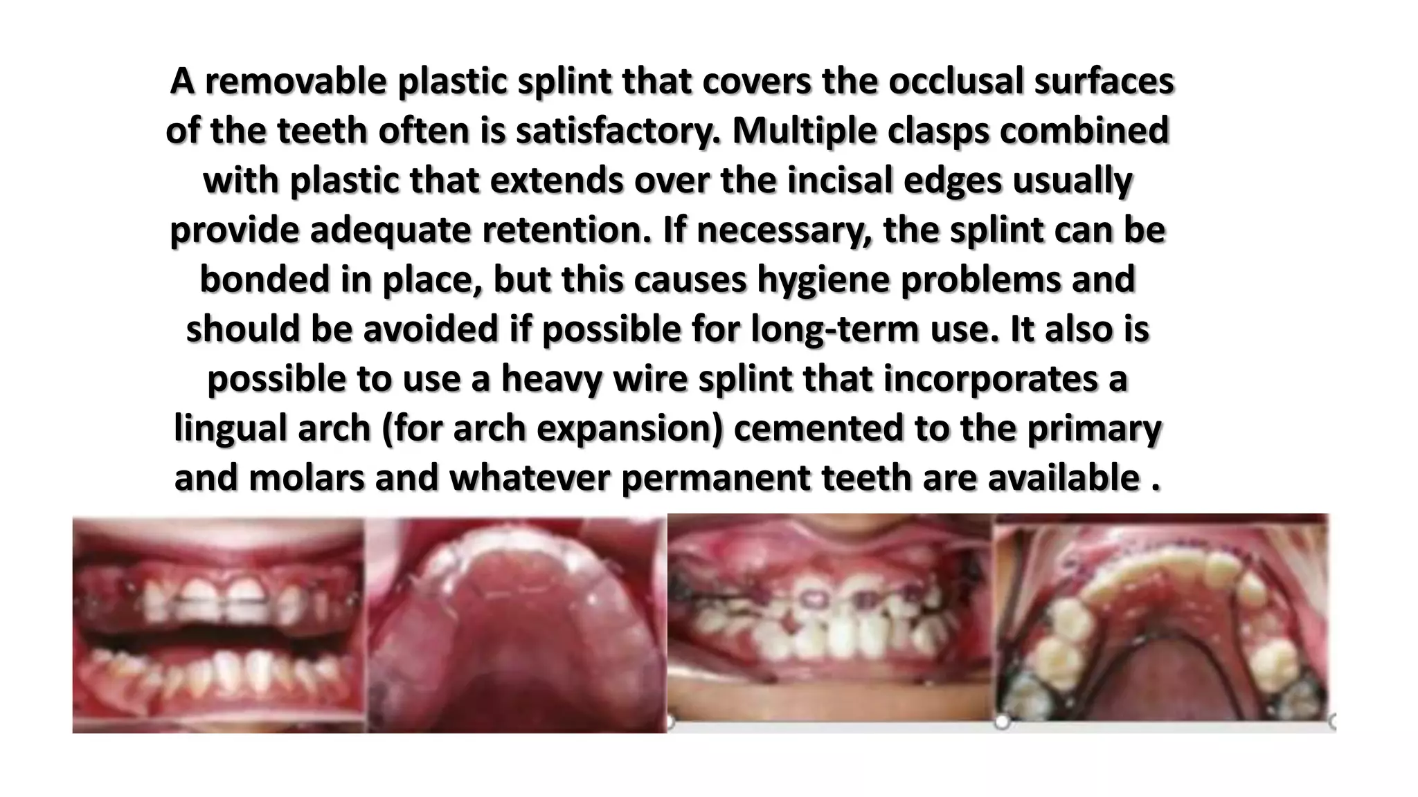 Orthopedic protraction of the maxilla part 1 | PPTX