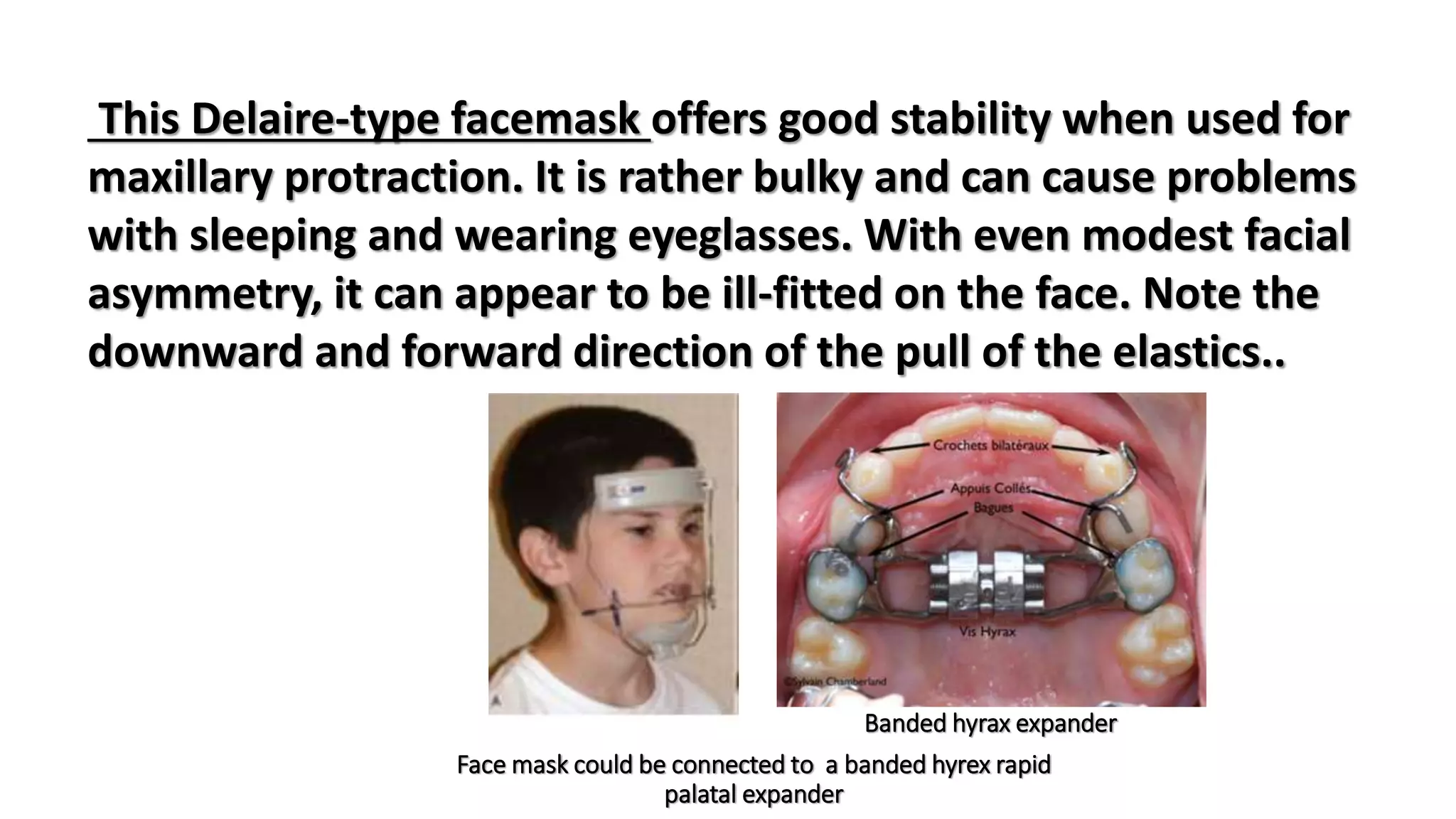 Orthopedic protraction of the maxilla part 1 | PPTX