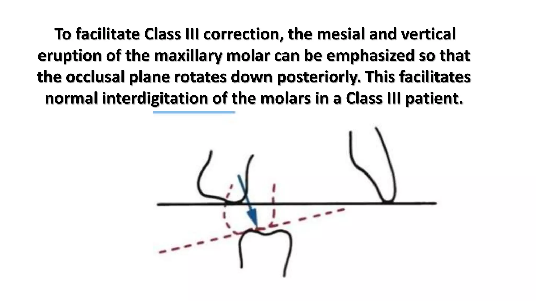 Orthopedic protraction of the maxilla part 1 | PPTX