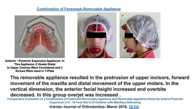 Orthopedic protraction of the maxilla part 1 | PPTX | Oral care | Personal Care