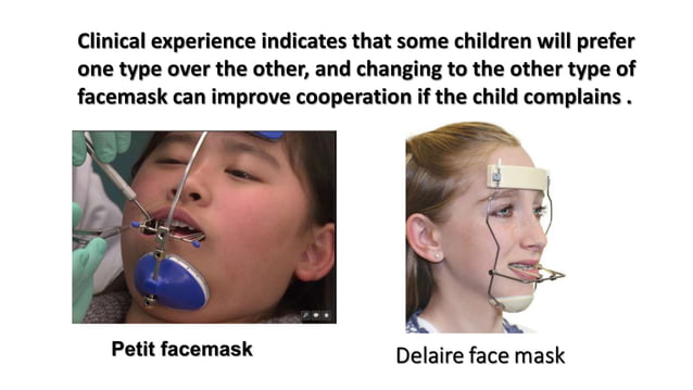 Orthopedic protraction of the maxilla part 1 | PPTX | Oral care | Personal Care