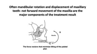 Orthopedic protraction of the maxilla part 1 | PPTX