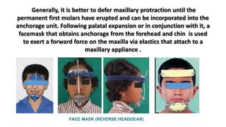 Orthopedic protraction of the maxilla part 1 | PPTX