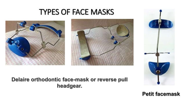 Orthopedic protraction of the maxilla part 1 | PPTX | Oral care | Personal Care