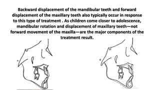 Orthopedic protraction of the maxilla part 1 | PPTX