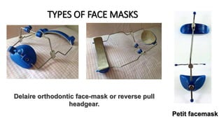 Orthopedic protraction of the maxilla part 1 | PPT