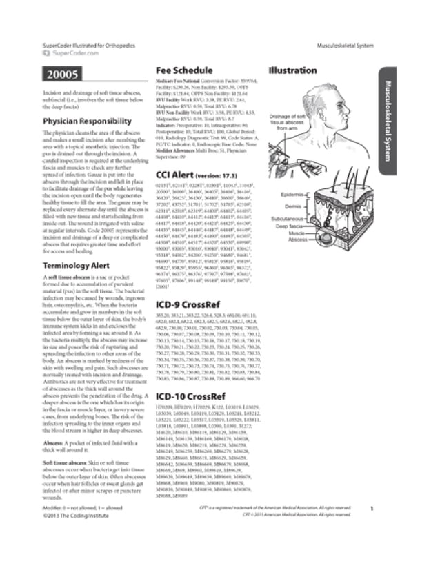 Orthopedics coding | PDF