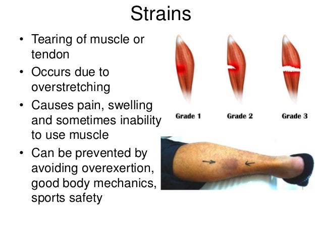Orthopedics for nurses