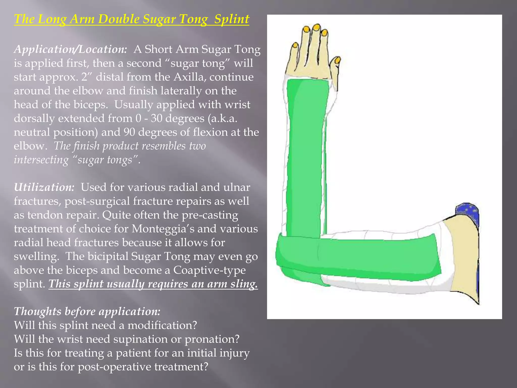 Orthopedic splinting | PPTX