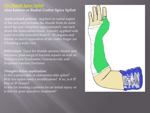 Orthopedic splinting | PPTX