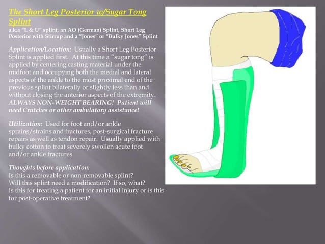Orthopedic splinting | PPTX