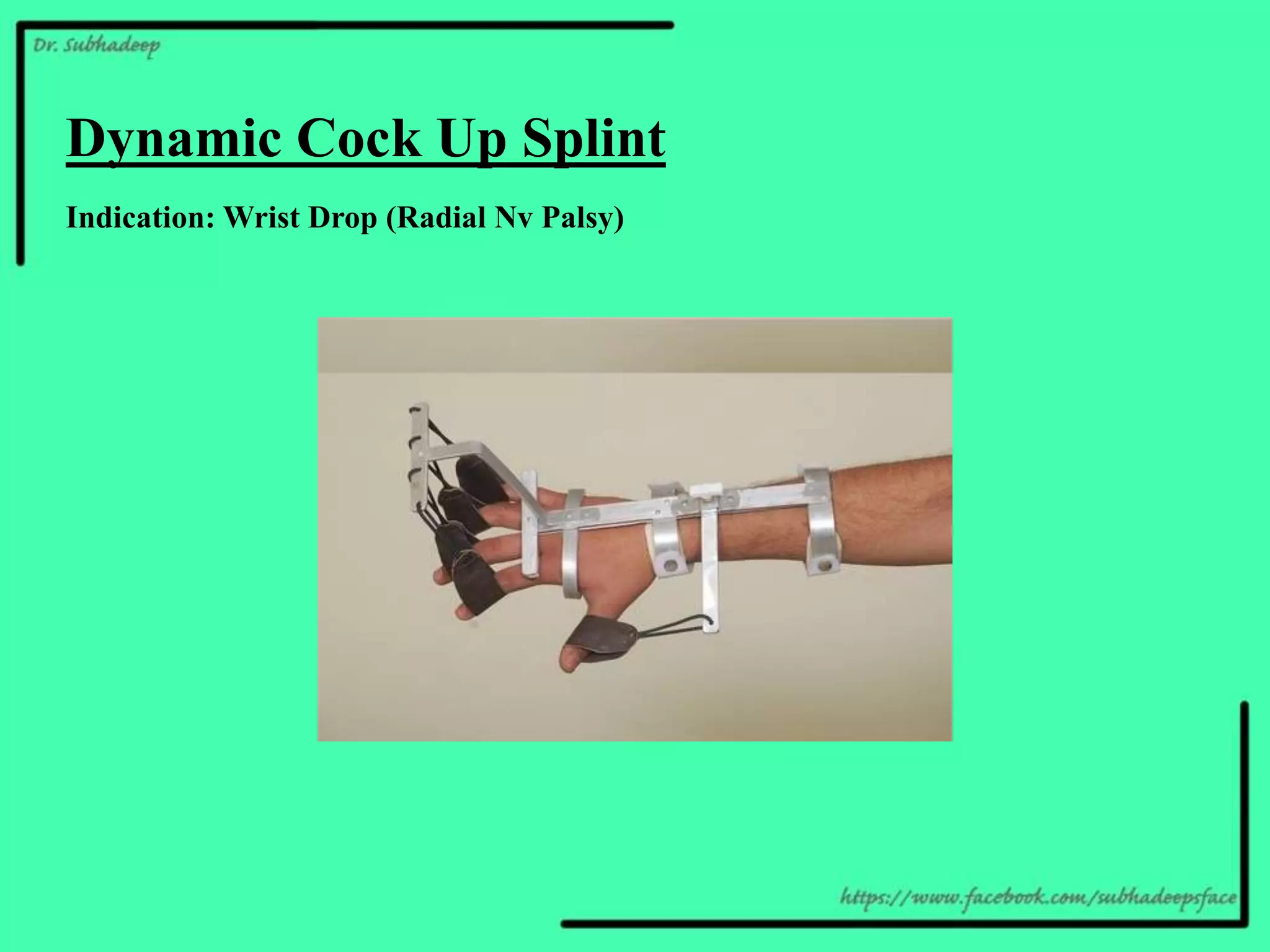 Orthopedic Splints and Casts- Subhadeep PGModules.pptx