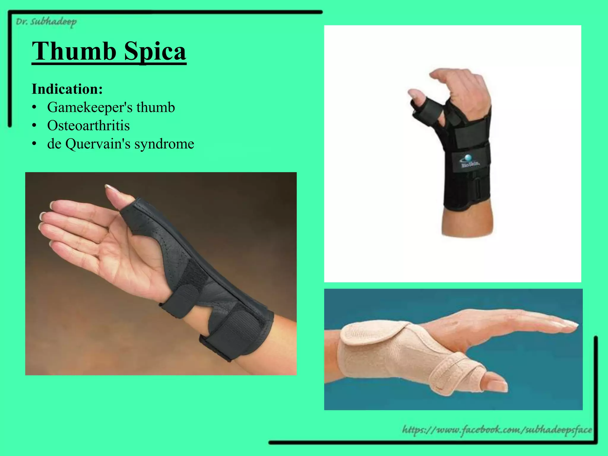 Orthopedic Splints and Casts- Subhadeep PGModules.pptx