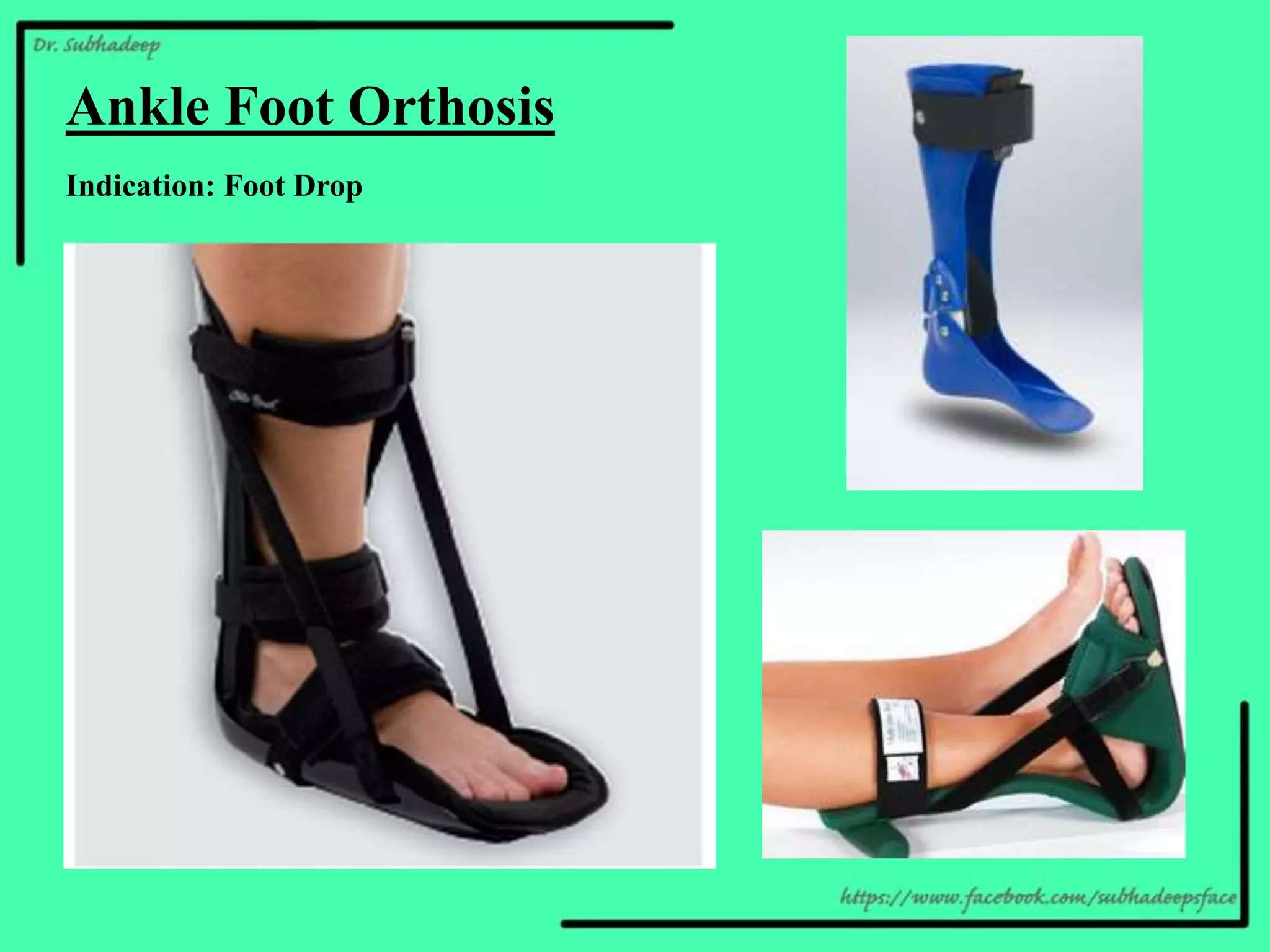 Orthopedic Splints and Casts- Subhadeep PGModules.pptx