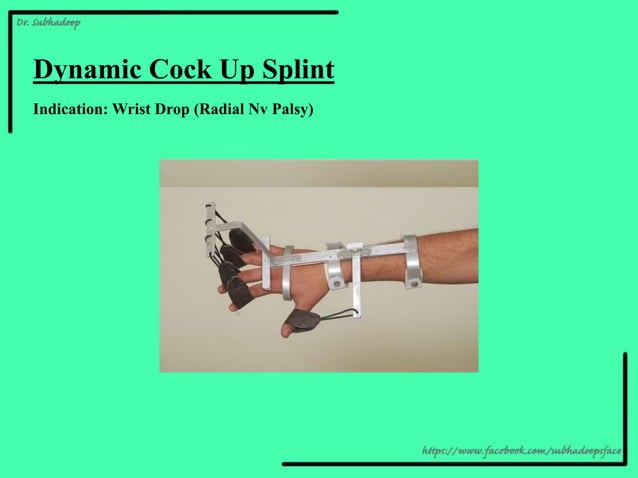 Orthopedic Splints and Casts- Subhadeep PGModules.pptx | Death, Injury, or Military Conflict ...