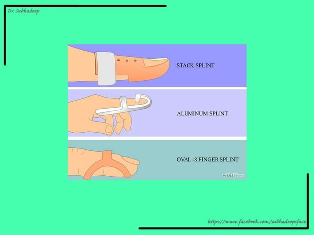 Orthopedic Splints and Casts- Subhadeep PGModules.pptx | Death, Injury ...