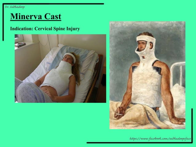 Orthopedic Splints and Casts- Subhadeep PGModules.pptx | Death, Injury ...