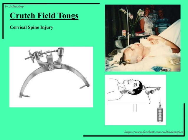 Orthopedic Splints and Casts- Subhadeep PGModules.pptx | Death, Injury ...